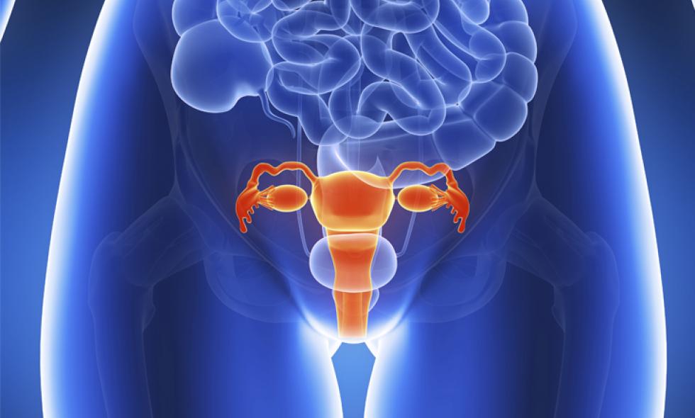 Día Mundial De Cáncer De Cuello Uterino ¿cómo Prevenir Esta Enfermedad